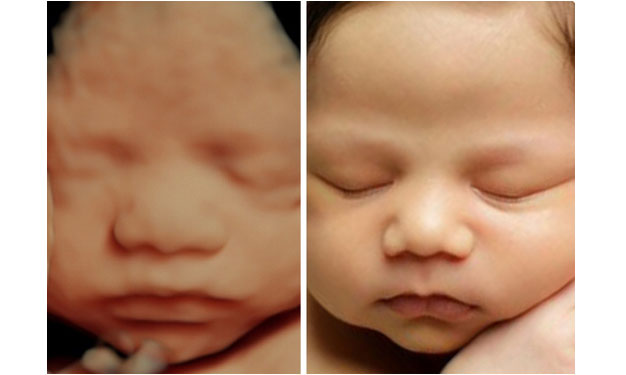3D 4D Ultrasound Neptune Diagnostics Center