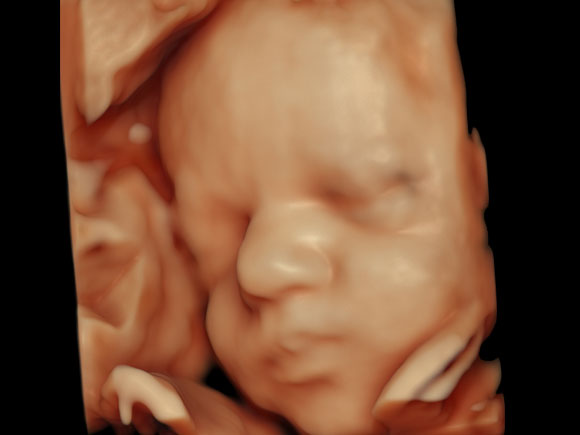 Best 3D 4D Ultrasound In Ghatkopar Chembur Kurla Neptune 